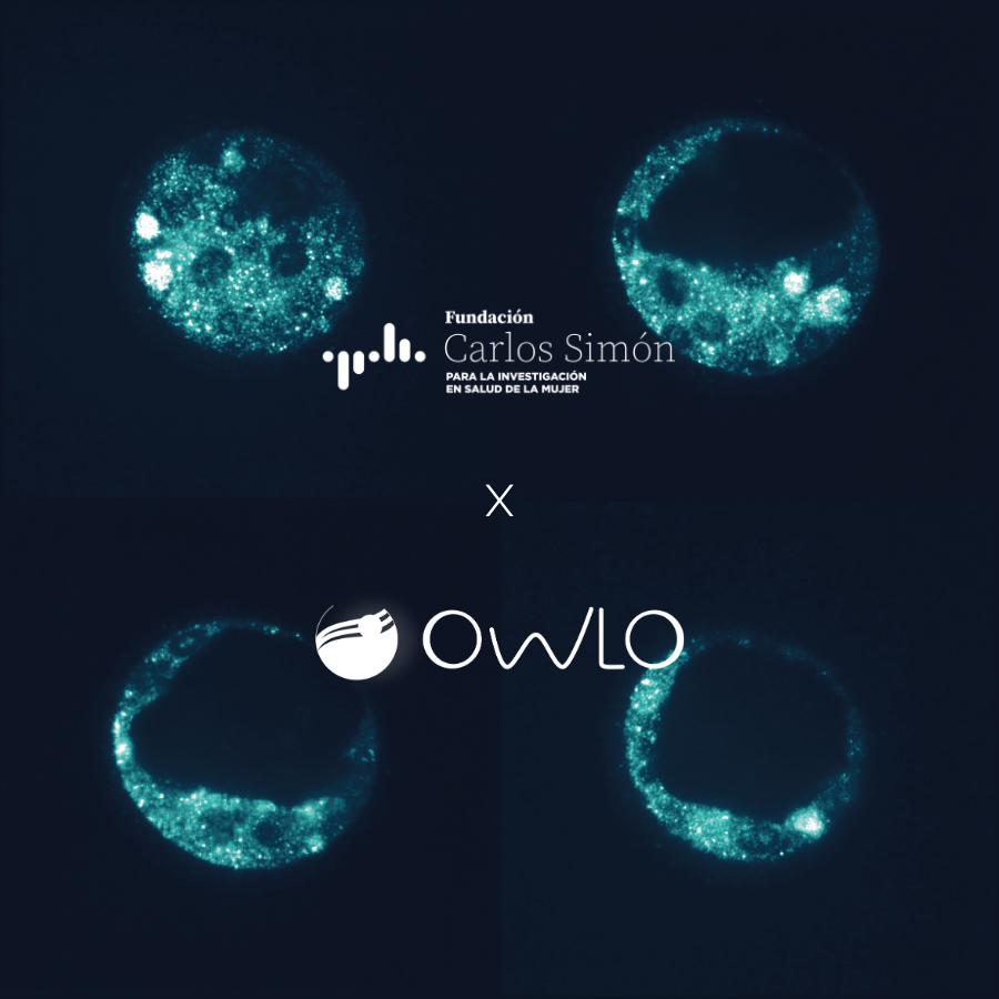 La Fundación Carlos Simón colabora con OWLO para mejorar la selección ...